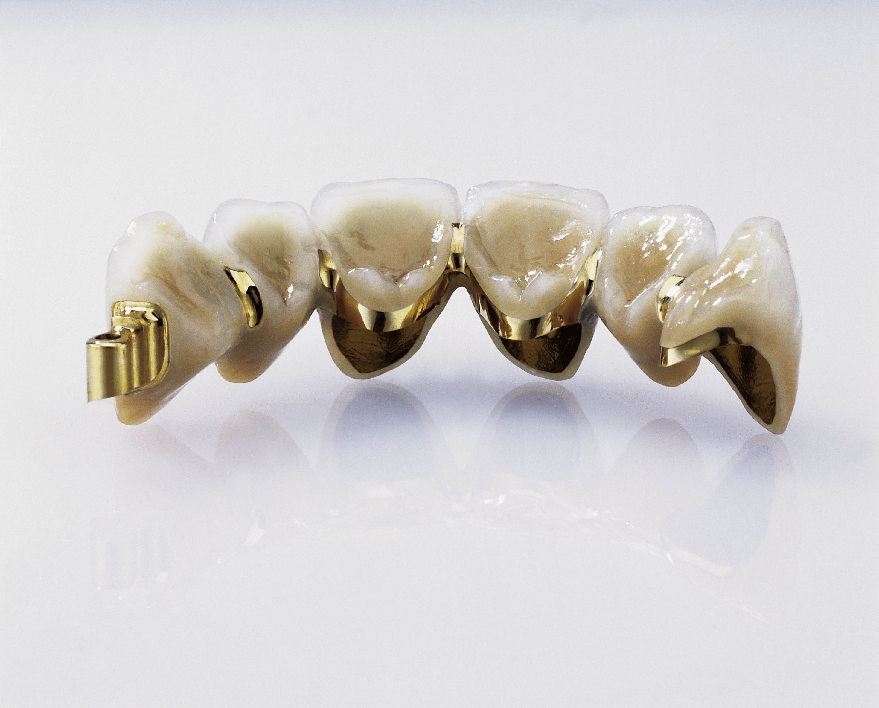 Metal-Based Crown & Bridge Materials | Dentsply Sirona UK