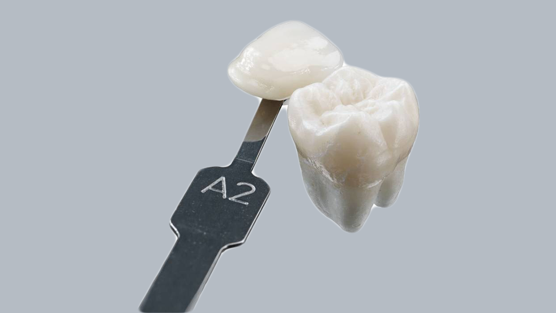 Composite shade matching: Challenges & Solutions | Dentsply Sirona USA