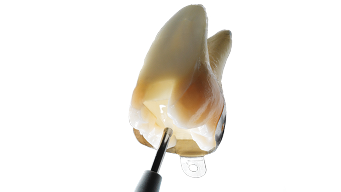 SDR® flow+ | Bulk Fill Flowable | Dentsply Sirona USA