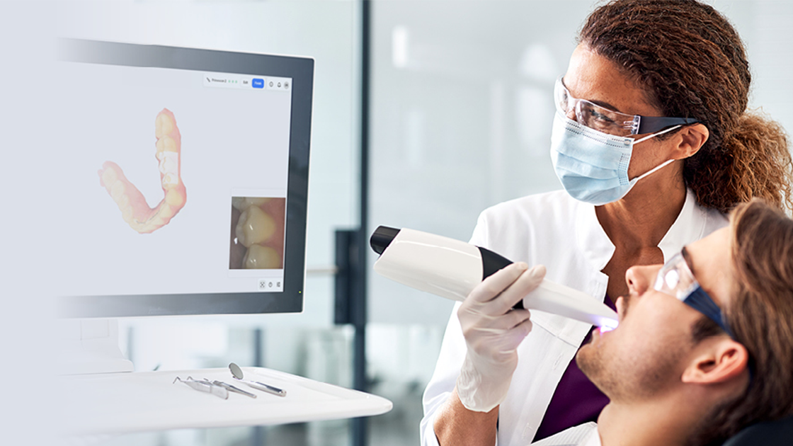 Tips & Tricks for Intraoral Scanning Denmark