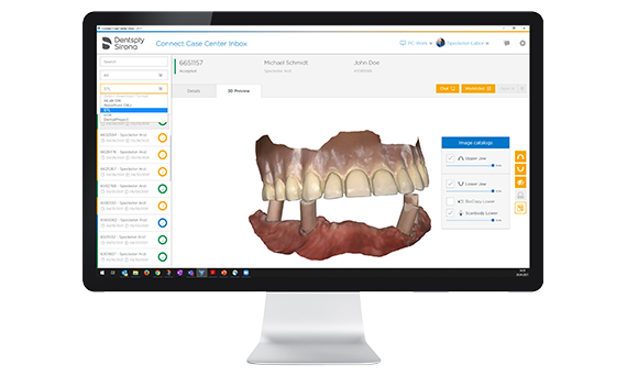 Digital Impression for Dental Labs | Dentsply Sirona UK