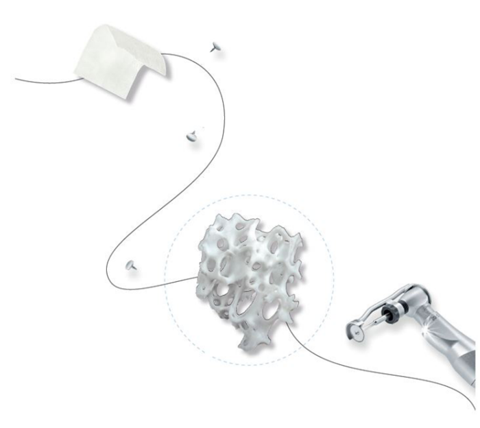 GBR & GTR Dental Membranes | Dentsply Sirona USA